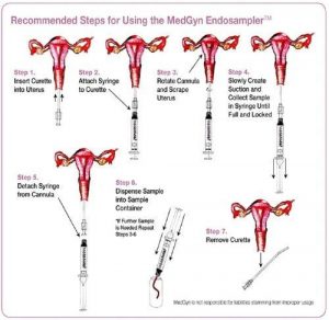 MedGyn Endosampler - dispozitiv unic de prelevare probe tisulare ...